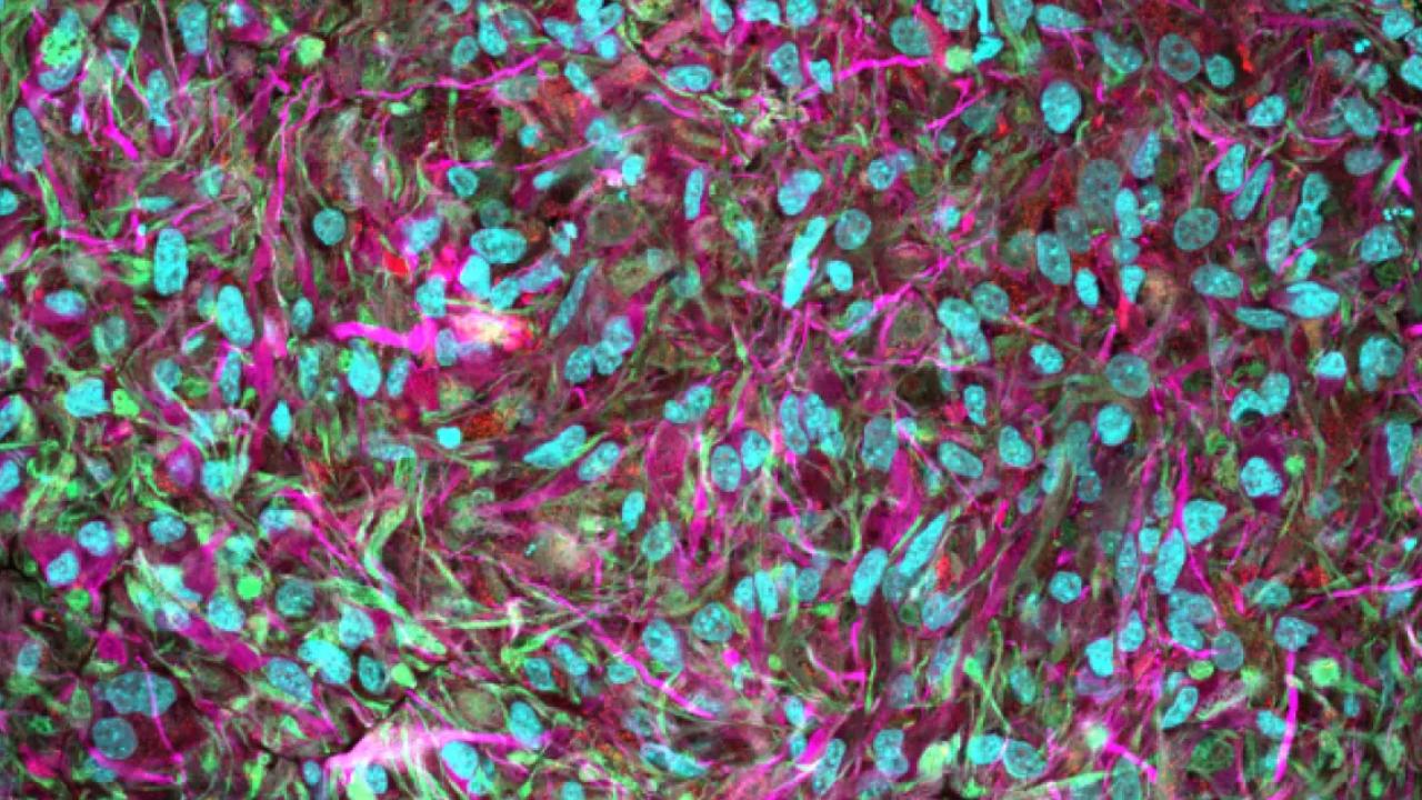 Intelligenza organoide: la nuova frontiera del biocomputing • W3B Today